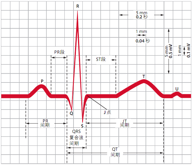ECG心电信号处理：初识ECG_ecg csdn-CSDN博客
