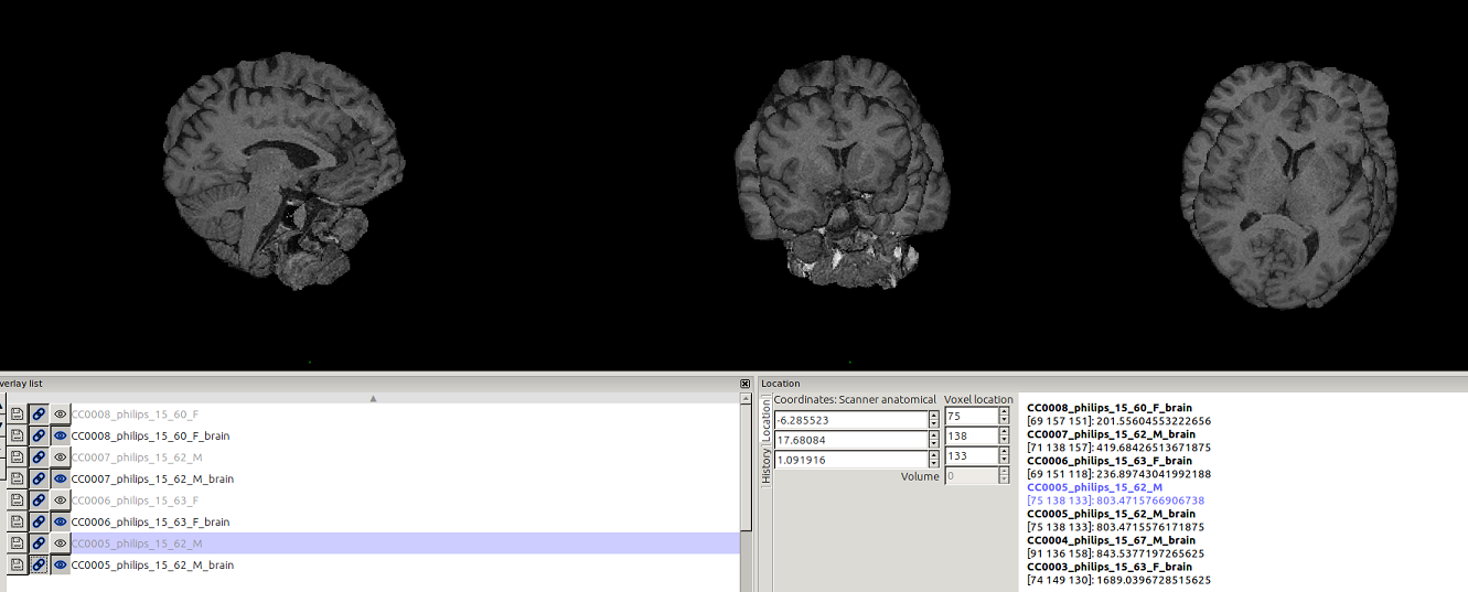 使用fsl进行MRI脑图像分析_fsl脑影像课程下载-CSDN博客