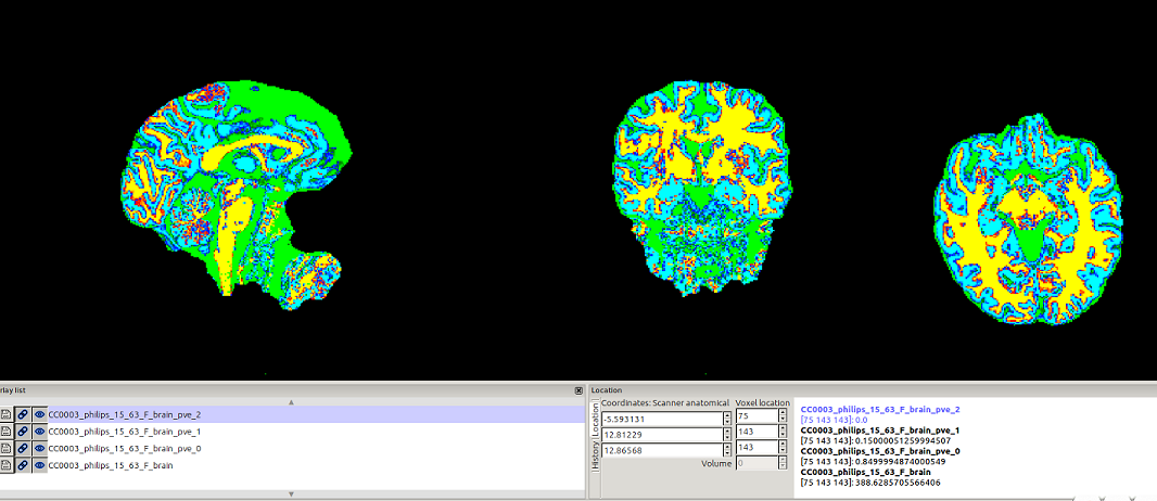 使用fsl进行MRI脑图像分析_fsl脑影像课程下载-CSDN博客