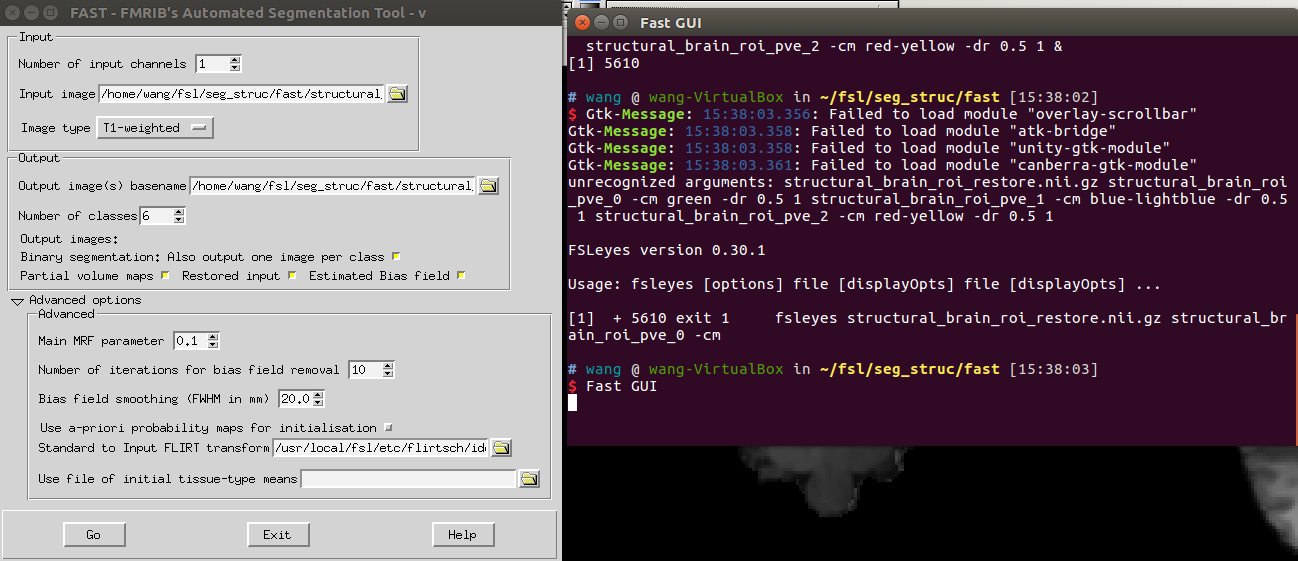 使用fsl进行MRI脑图像分析_fsl脑影像课程下载-CSDN博客
