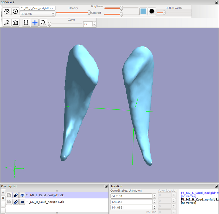 使用fsl进行MRI脑图像分析_fsl脑影像课程下载-CSDN博客