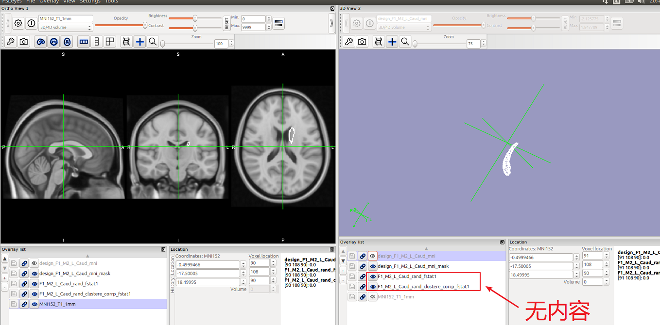 使用fsl进行MRI脑图像分析_fsl脑影像课程下载-CSDN博客