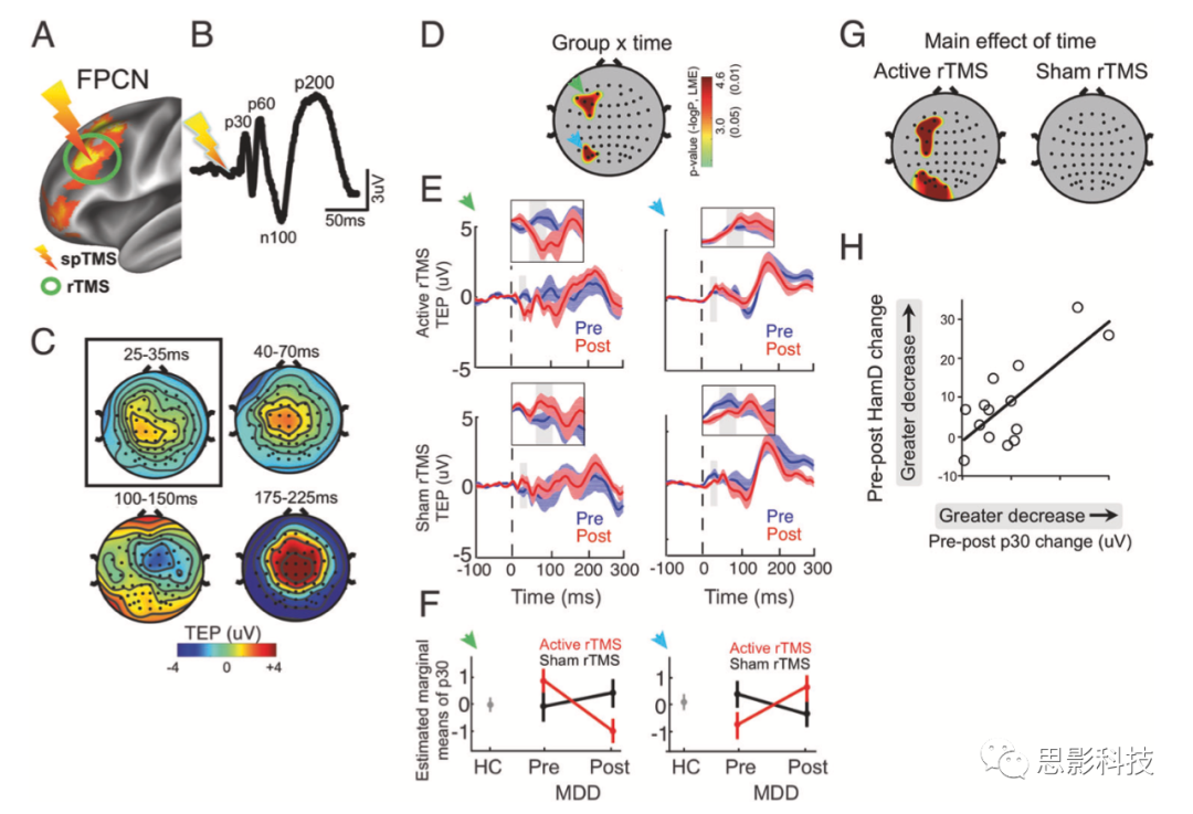 NPP: 重复经颅磁刺激产生抗抑郁效果的基础：全脑功能连接与局部兴奋度变化-CSDN博客