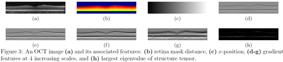 OCT图像层次分割相关论文泛读_oct分割-CSDN博客