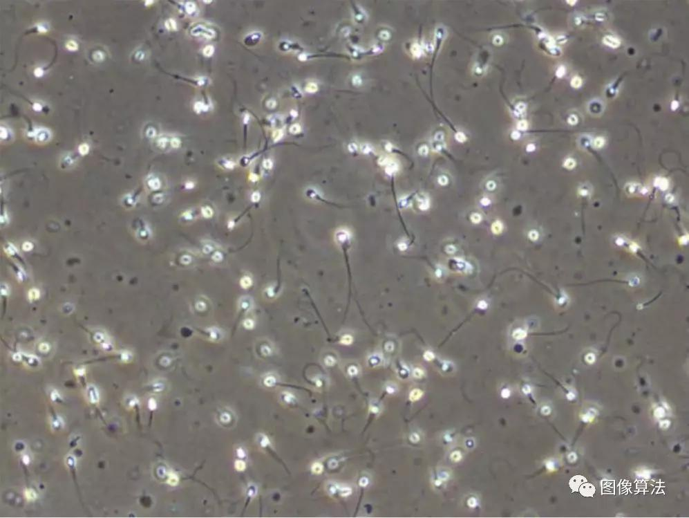 基于机器学习算法预测男性精子生育力的分析与研究_人工智能男性生育力评估-CSDN博客