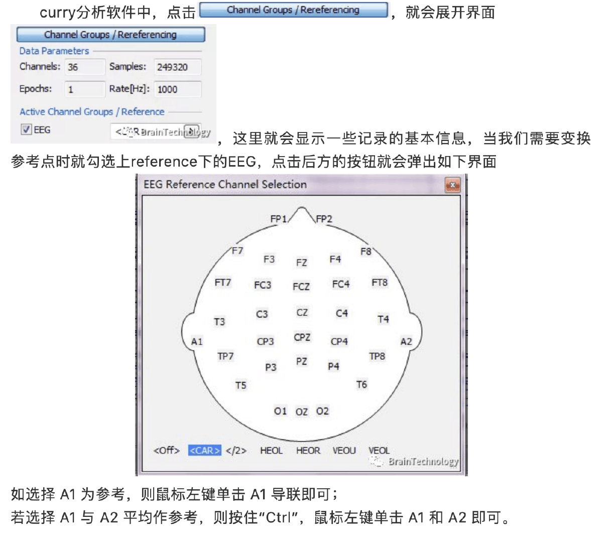 2020-02-28-脑电分析之参数变换_Chen Rui blog-CSDN博客