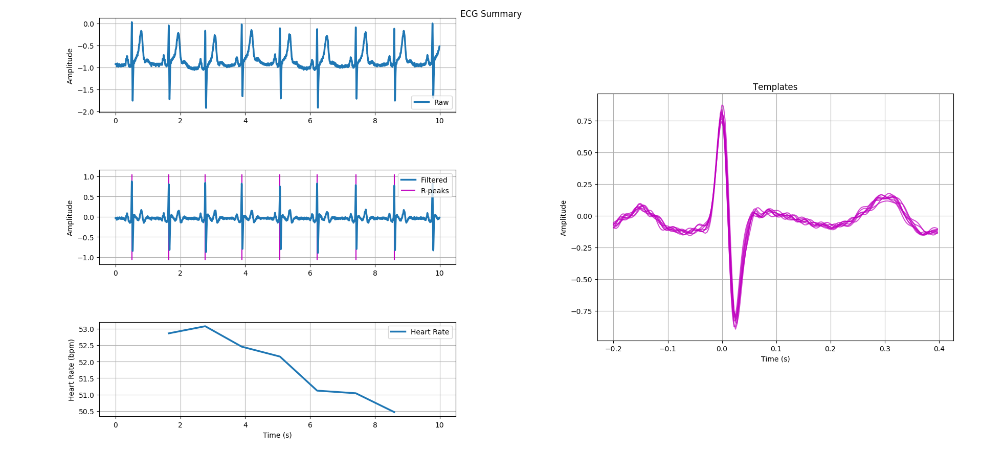 轻量级生理信号处理工具BioSPPy中的ECG（3）-CSDN博客