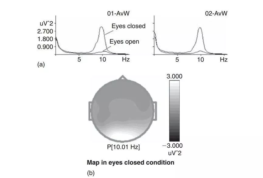 浅谈脑电的alpha频段振荡_alpha oscillation-CSDN博客