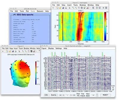 基于分类任务的信号(EEG)处理_eeg信号使用分类器分类-CSDN博客