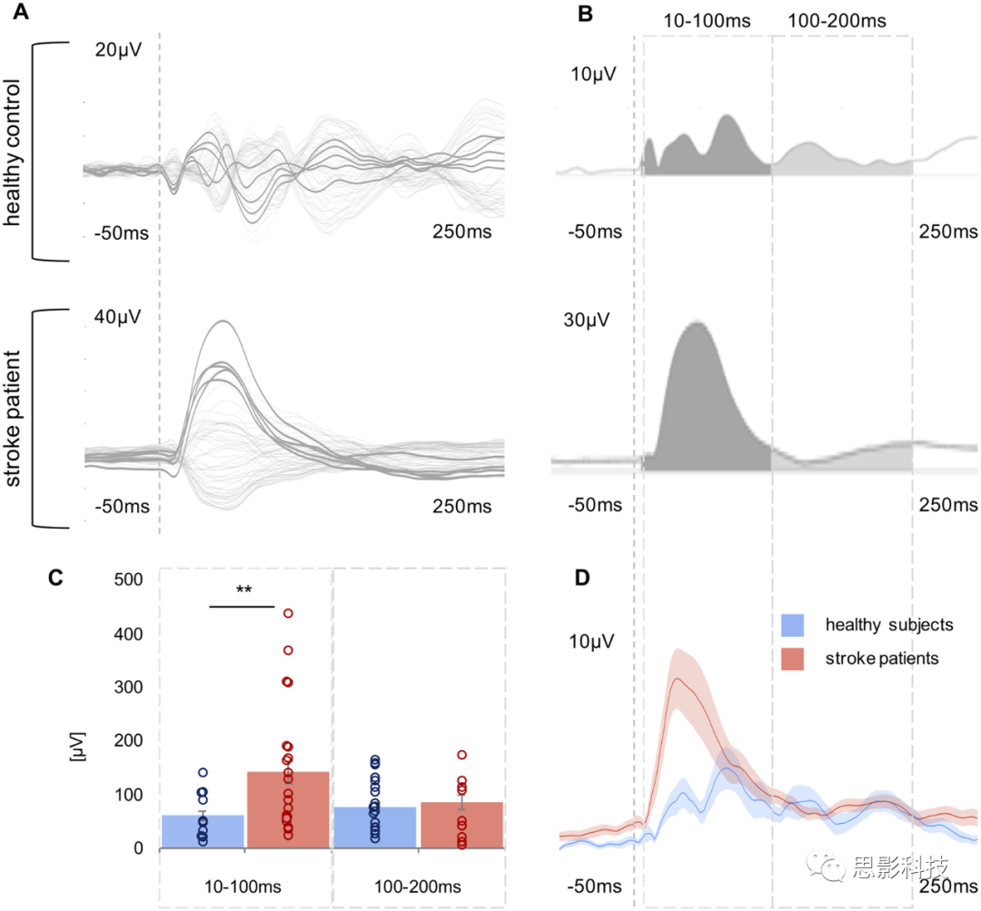 BRAIN：TMS-EEG研究：大脑反应为卒中后的运动恢复提供个体化数据_事件相关频谱扰动-CSDN博客