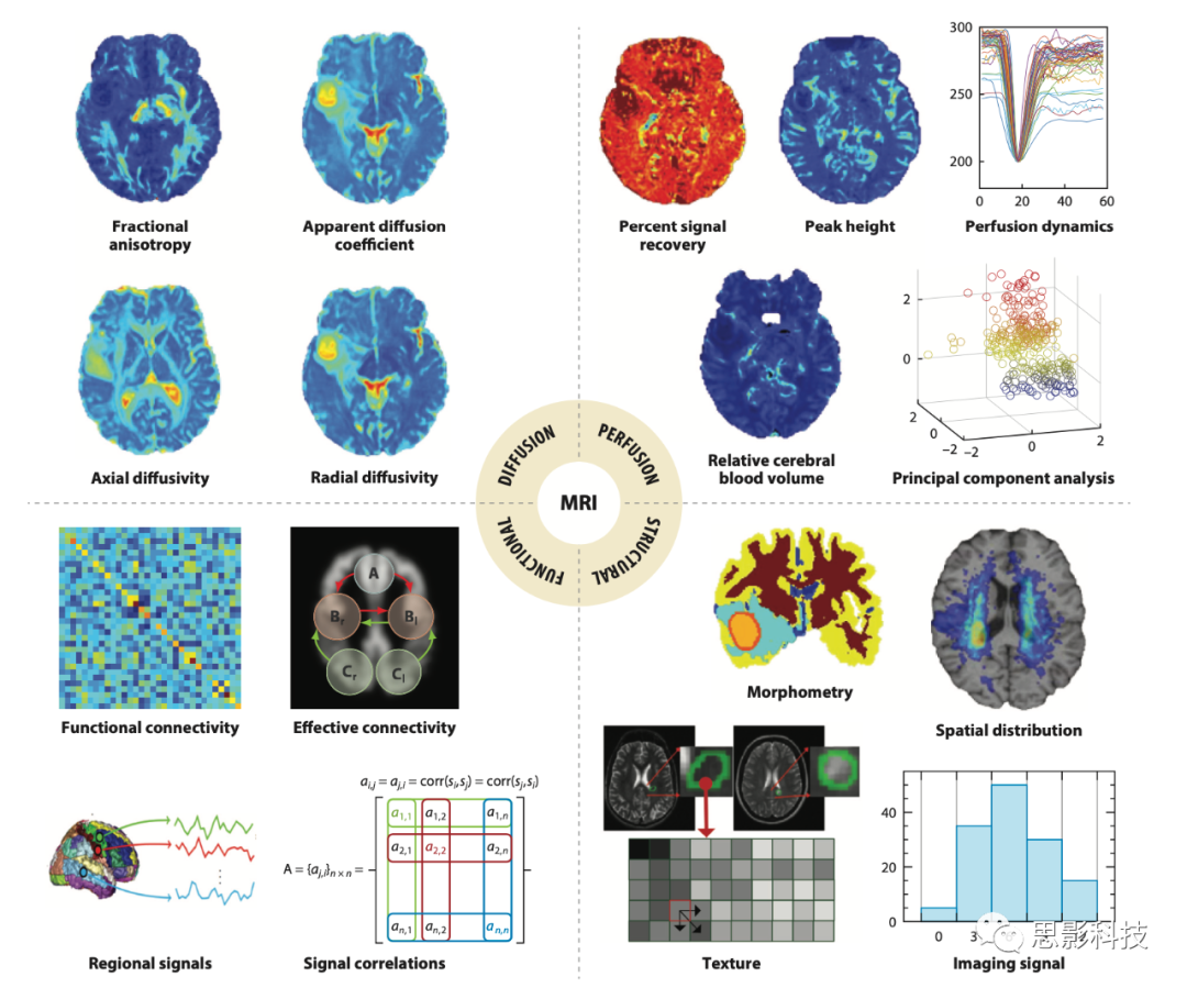 神经放射学诊断中的MRI数据分析_数据处理里如何识别不同病人的磁共振图像-CSDN博客