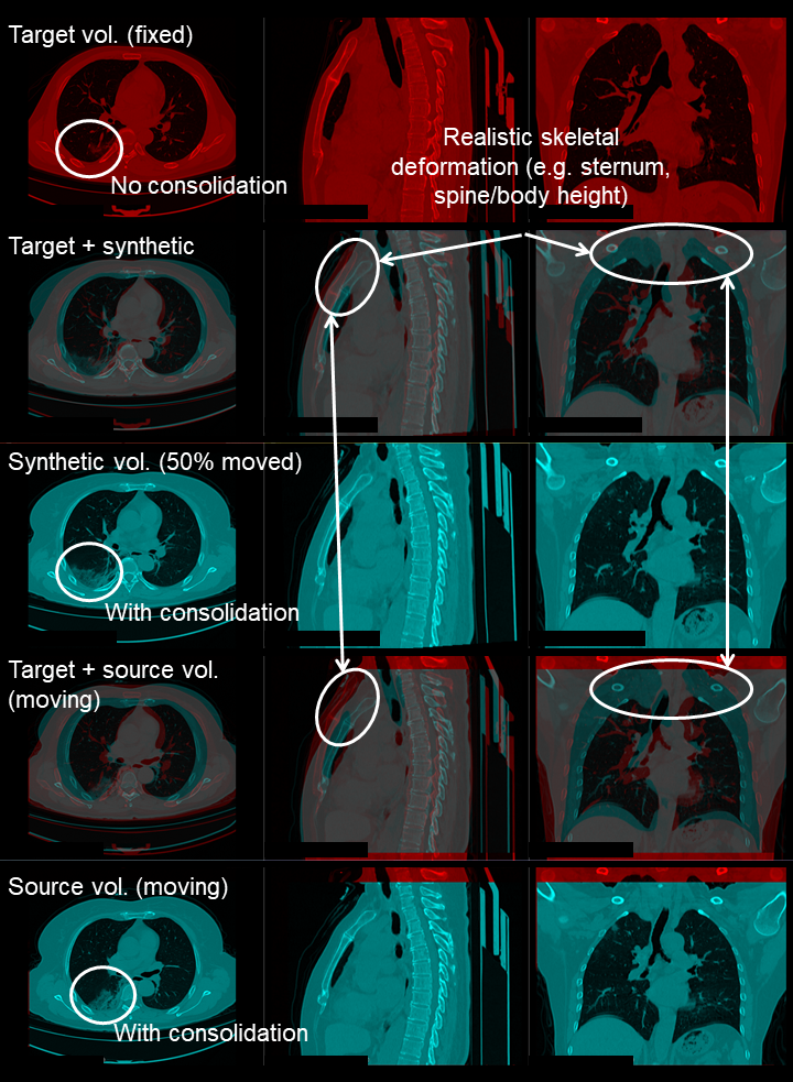 创建合成CT图像数据-CSDN博客