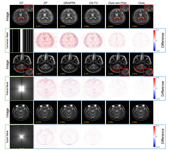 CVPR 2020 论文大盘点-医学影像处理识别篇_asyndgan_OpenCV中文网公众号的博客-CSDN博客