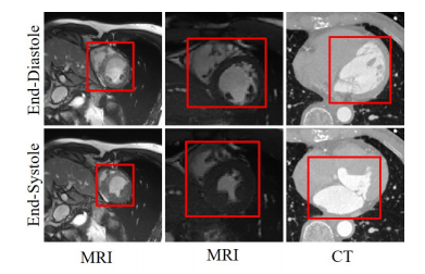 CVPR 2020 论文大盘点-医学影像处理识别篇_asyndgan_OpenCV中文网公众号的博客-CSDN博客