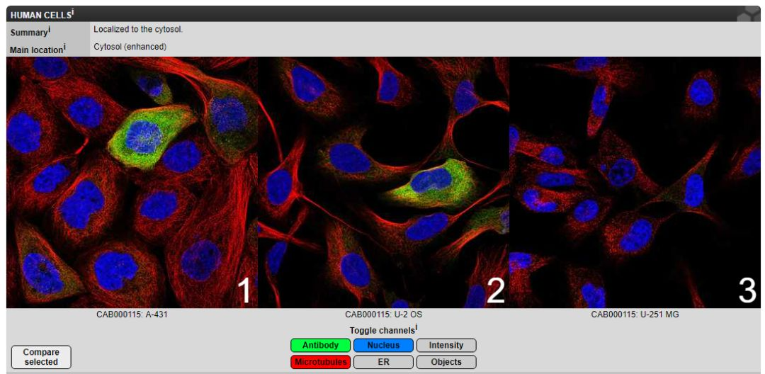 HPA:人类蛋白图谱数据库-CSDN博客