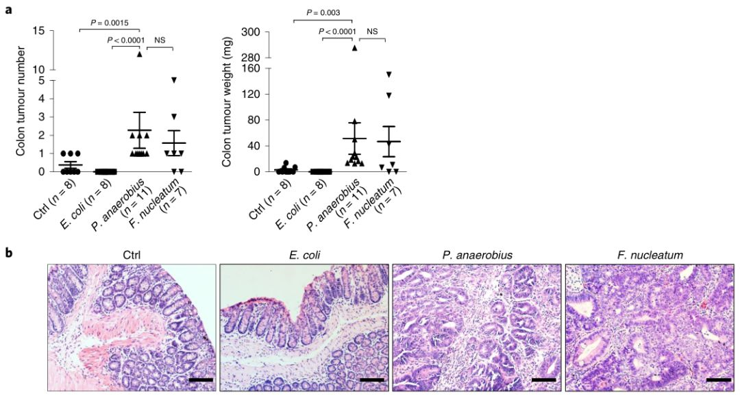 Nature子刊：厌氧消化链球菌促进结直肠癌发生及调节肿瘤免疫-CSDN博客
