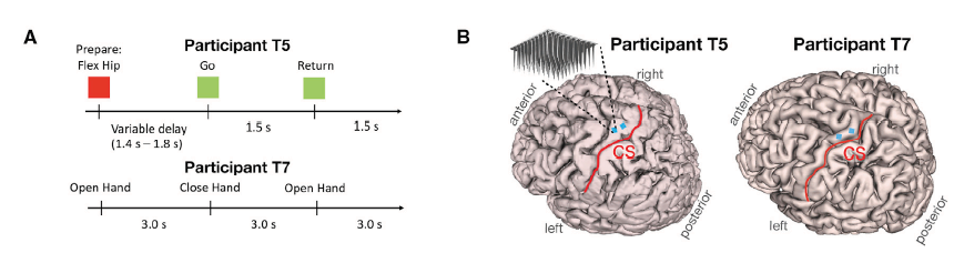 最新大脑图谱研究表明，手部的运动区域也与整个身体相连_hand knob area of premotor cortex represents ...