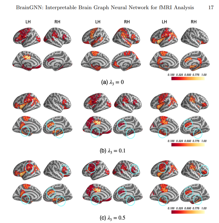 图神经网络 | BrainGNN: 用于功能磁共振成像分析的可解释性脑图神经网络_braingnn: interpretable brain graph neural network-CSDN博客