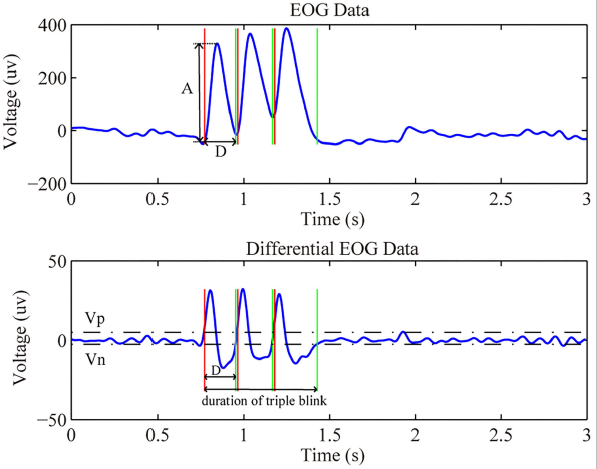 基于SSVEP-EOG的混合BCI用于机械臂控制_基于 eog 和 ssvep-CSDN博客