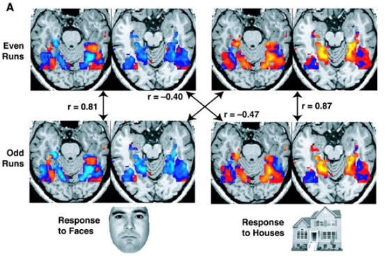 快速入门脑机接口：BCI基础(一)_脑电侵入式检测-CSDN博客