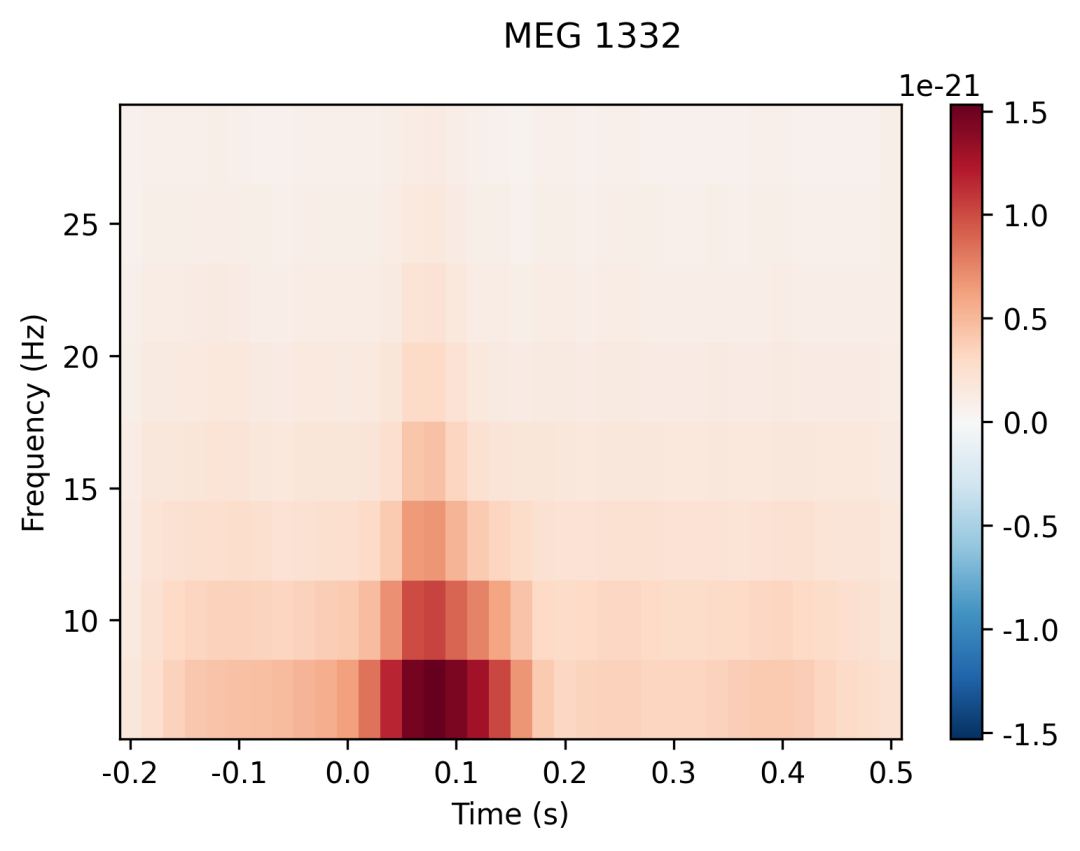 使用mne进行脑电信号分析_mne α频率-CSDN博客