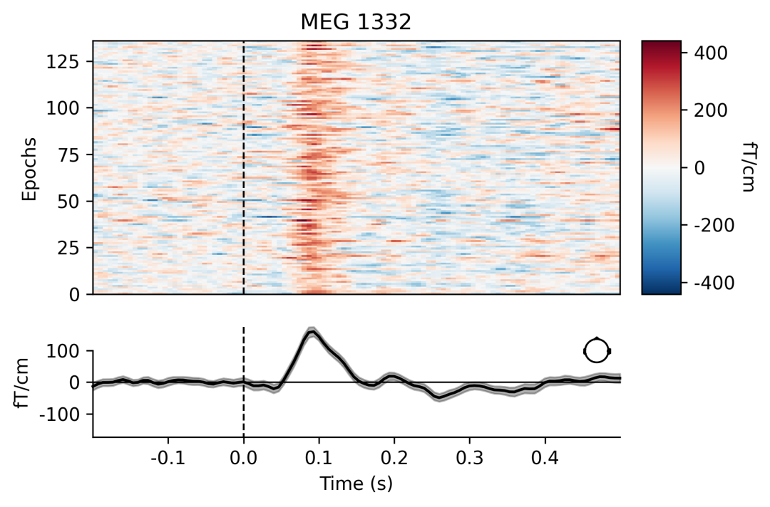 使用mne进行脑电信号分析_mne α频率-CSDN博客