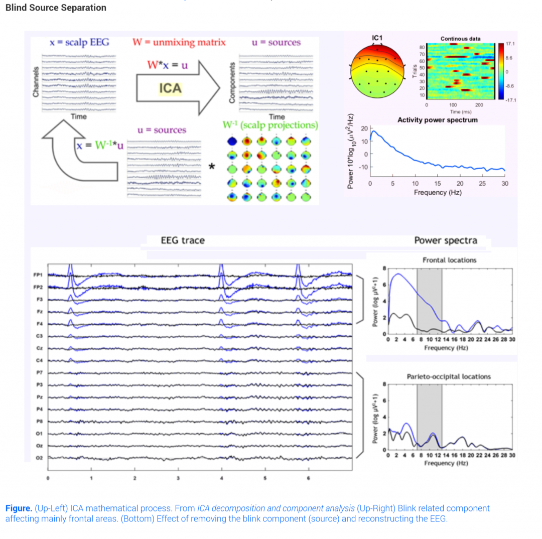 EEG伪影详解和过滤工具的汇总(二)_eeglab伪影-CSDN博客