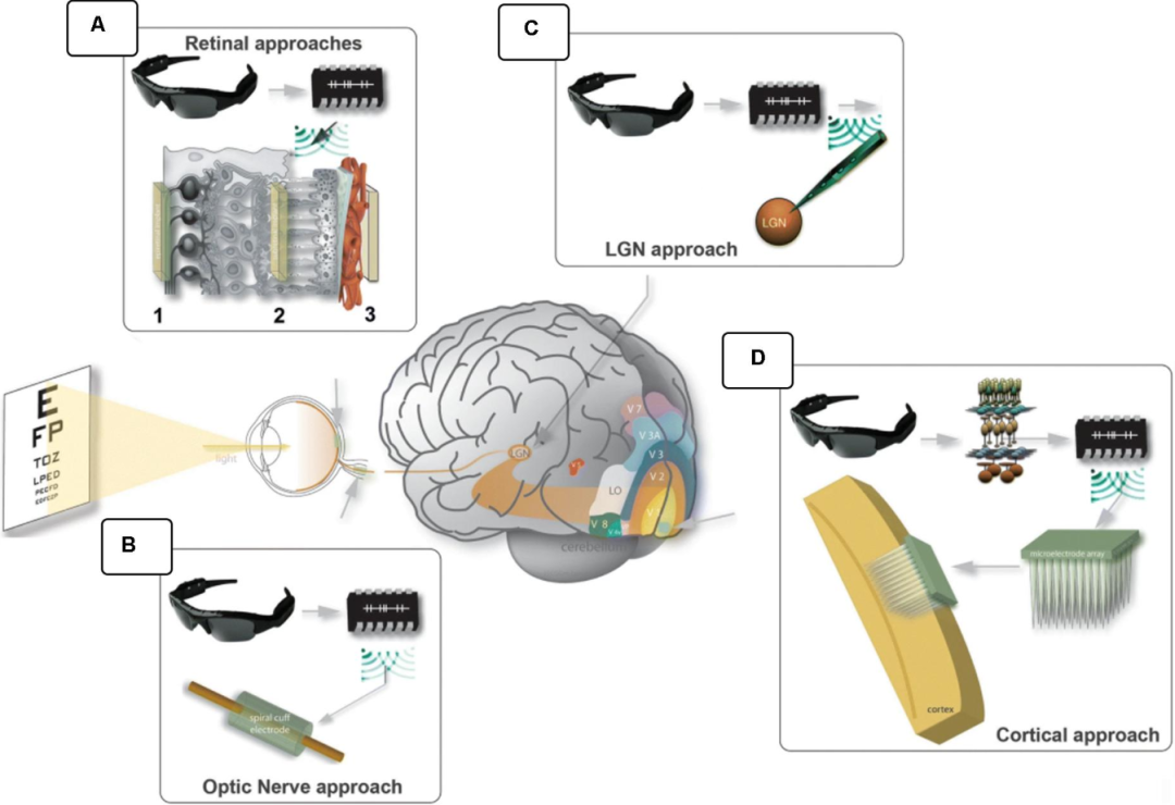用于视力恢复的脑机接口综述(一)_脑机接口治疗视神经-CSDN博客