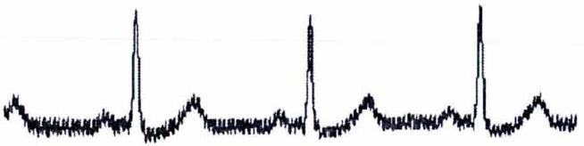 使用Python+TensorFlow2构建基于卷积神经网络（CNN）的ECG心电信号识别分类（三）_执执执念的博客-CSDN博客
