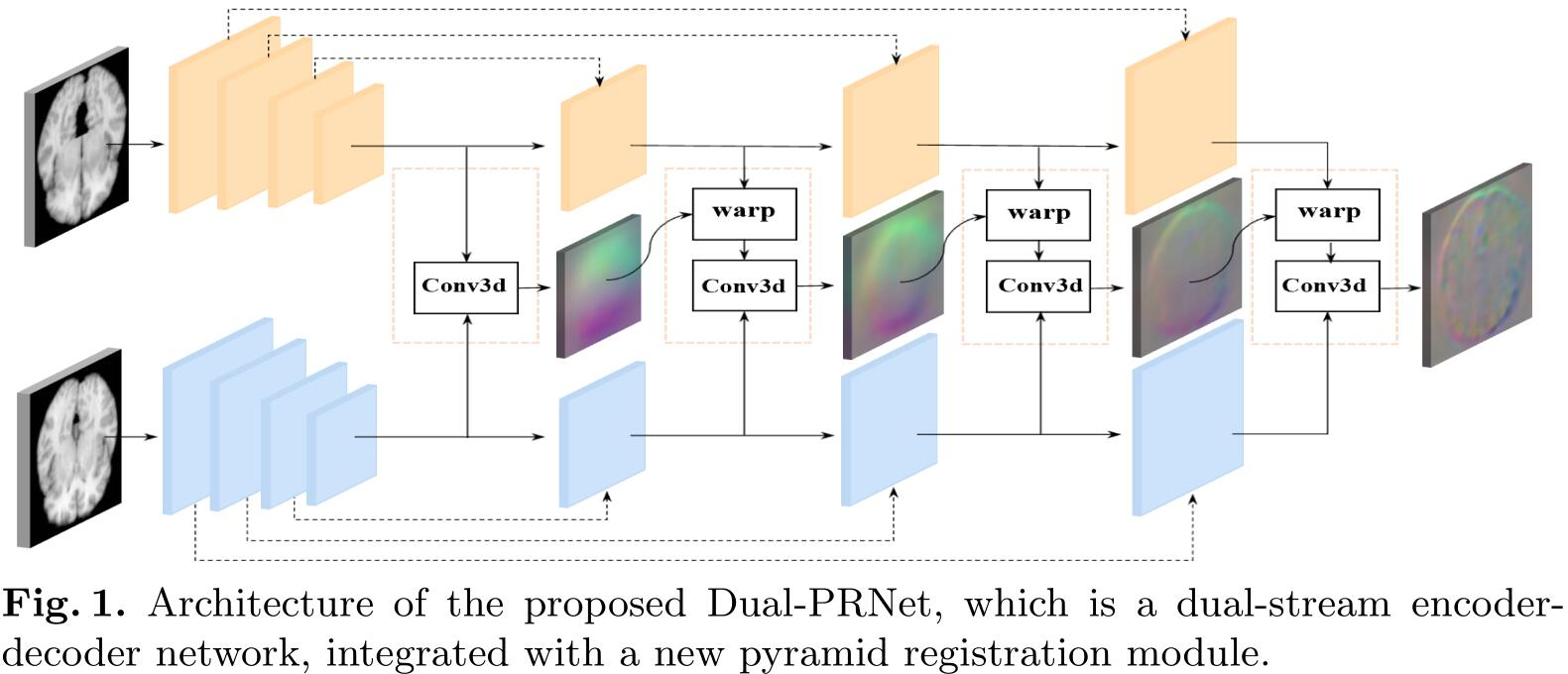 【论文笔记】双流金字塔配准网络——Dual-PRNet_dual-stream pyramid registration network-CSDN博客