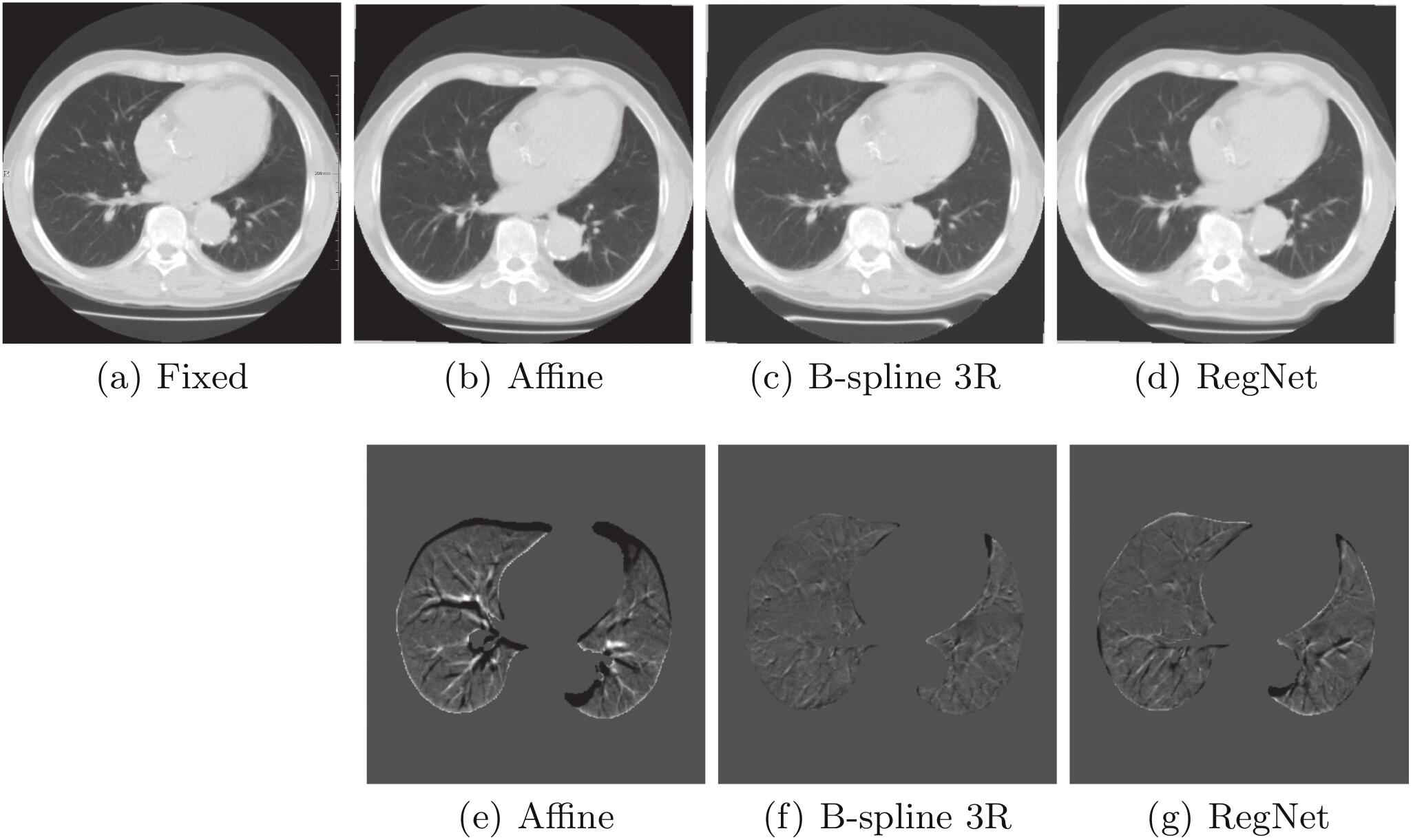 【论文笔记】Nonrigid Image Registration Using Multi-scale 3D Convolutional Neural Networks-CSDN博客